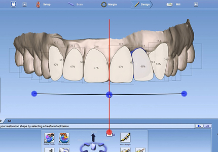 The concept of Straumann implants
